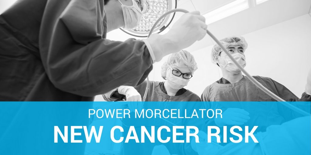 JAMA: New Morcellation Device Does Not Eliminate Cancer Risk
