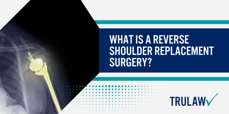 Zimmer Biomet Reverse Shoulder Lawsuits | TruLaw