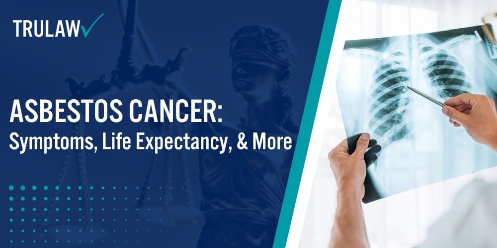 Asbestos Cancer: Symptoms, Life Expectancy, & More | TruLaw